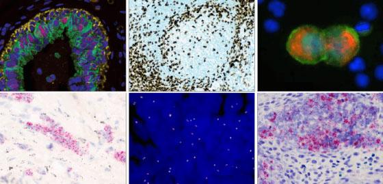BOND RXm | IHC Academic Research Stainer
