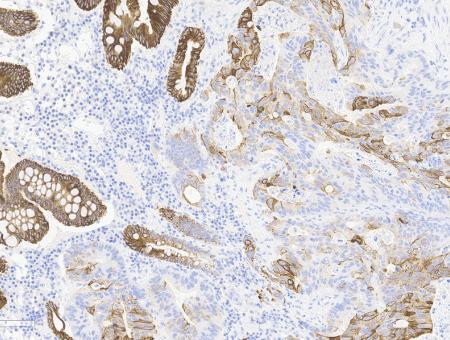 IHC and ISH solution that delivers optimal results