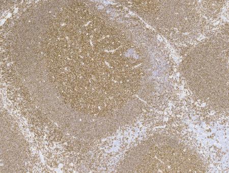 IHC and ISH solution that delivers optimal results