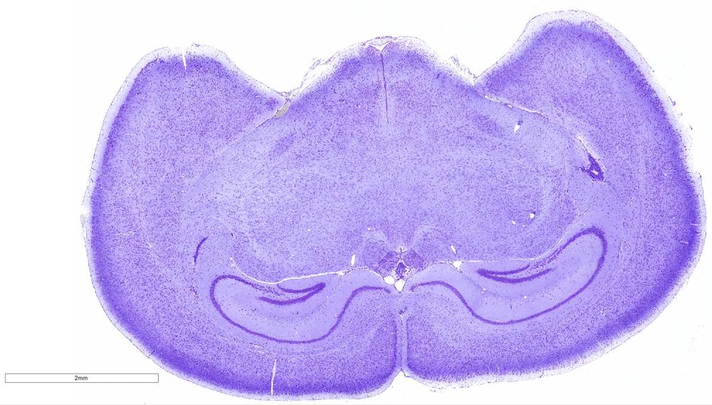Aperio FL Systems - Brightfield, Fluorescent & FISH Scanning