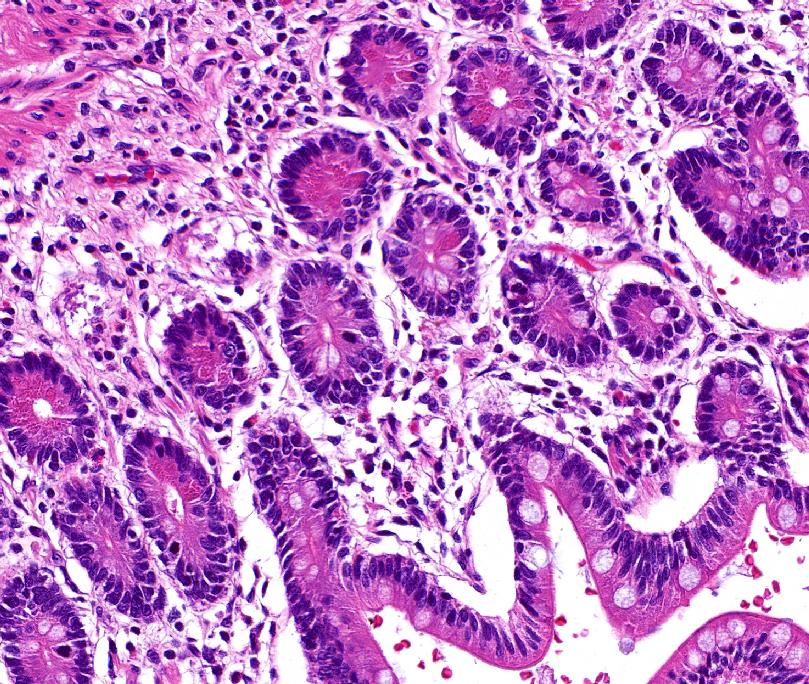 Aperio FL Systems - Brightfield, Fluorescent & FISH Scanning