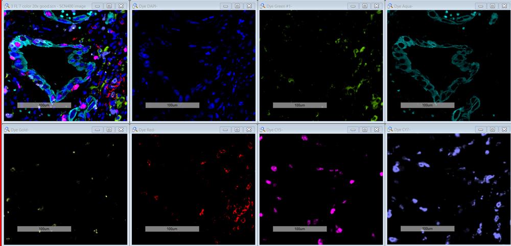Aperio FL Systems - Brightfield, Fluorescent & FISH Scanning