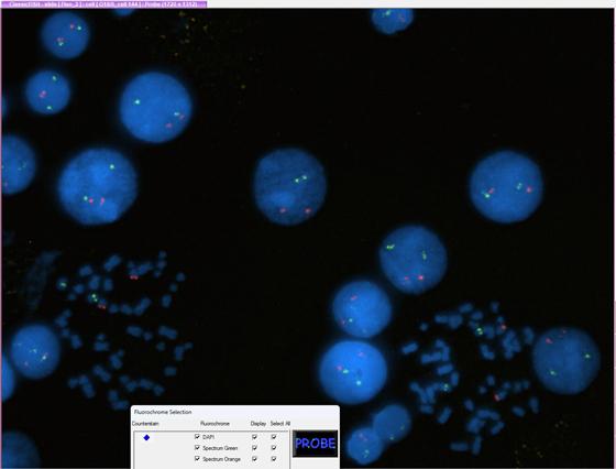 CytoVision DX - Streamline Your Cytogenetics Workflow
