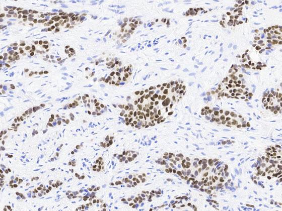 Breast ER AI for Breast Cancer Sample Analysis