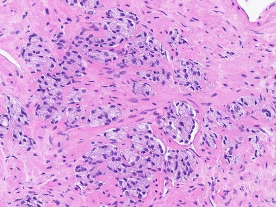 Prostate AI for H&E-Stained Prostate Sample Analysis