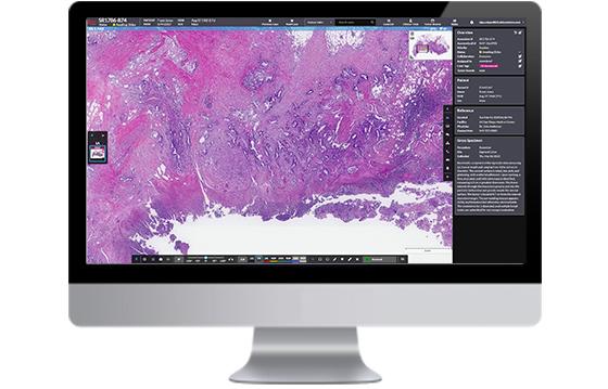 HALO AP Image Management Solution