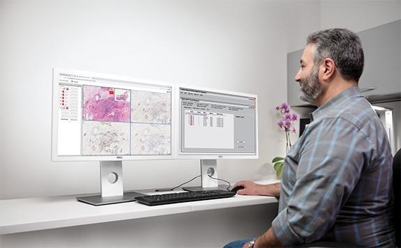 Aperio LIS Connectivity Software | Integrated Data for LIS/LIMS
