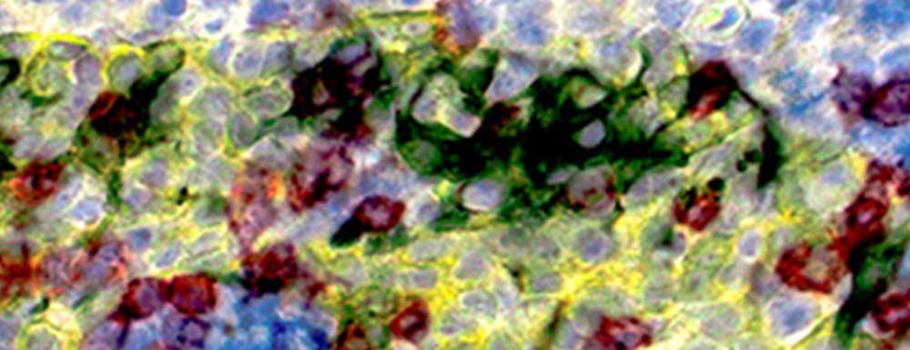 Advanced Staining Image Gallery | Leica Biosystems
