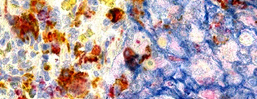 Advanced Staining Image Gallery | Leica Biosystems