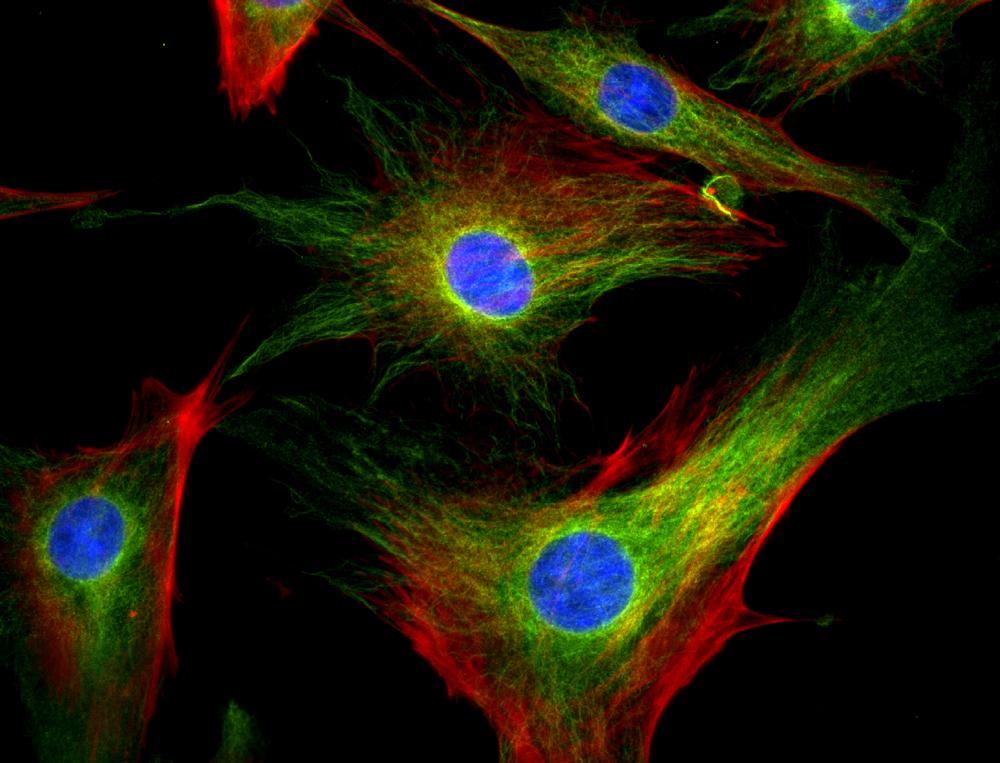 Aperio FL Systems - Brightfield, Fluorescent & FISH Scanning