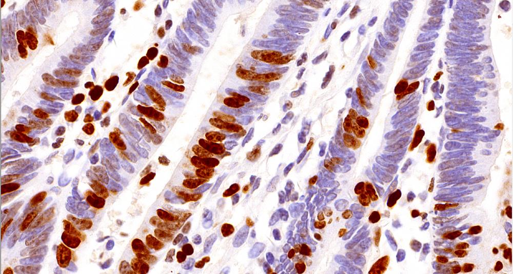 Aperio FL Systems - Brightfield, Fluorescent & FISH Scanning