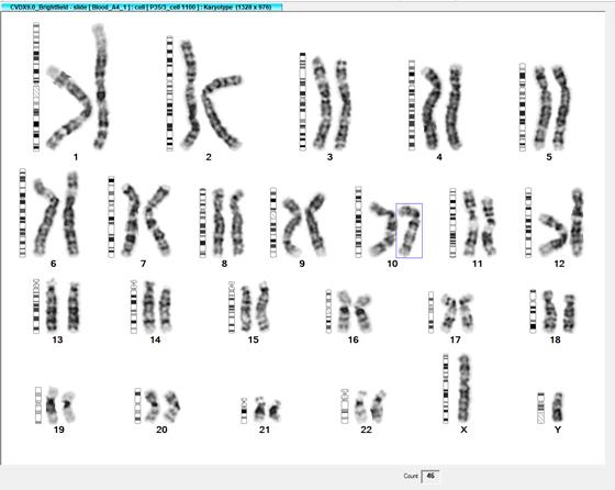 CytoVision DX - Streamline Your Cytogenetics Workflow