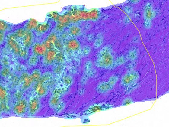 Lung Macrodissect AI | Leica Biosystems