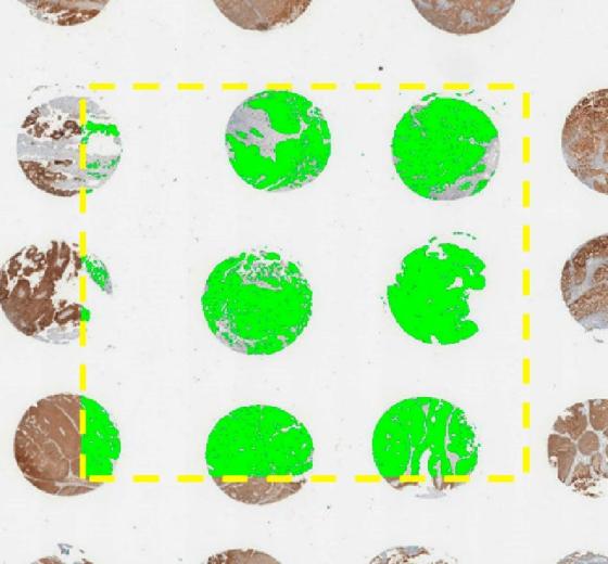 Aperio CS2 - Digital Pathology Scanner