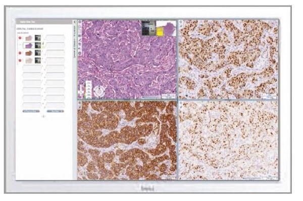 Aperio CS2 | Digital Pathology Slide Scanner