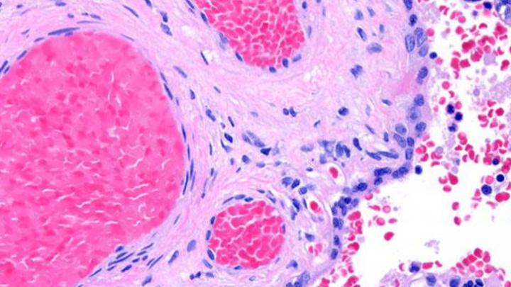 HistoCore SPECTRA ST | 全自动 H&E 染色机