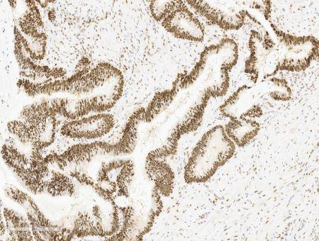 IHC and ISH solution that delivers optimal results