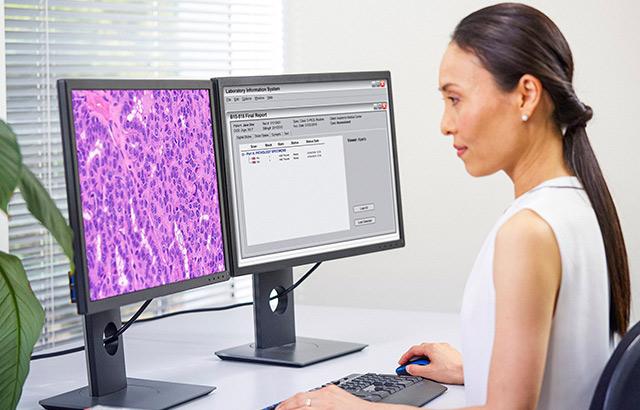 Aperio CS2 | Digital Pathology Slide Scanner Aperio CS2 | Digital Pathology Slide Scanner