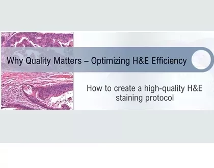 Fundamentals of Hematoxylin and Eosin Staining | Leica Biosystems