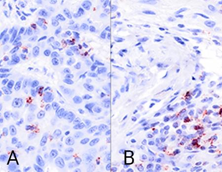 Navinci | Leica Biosystems