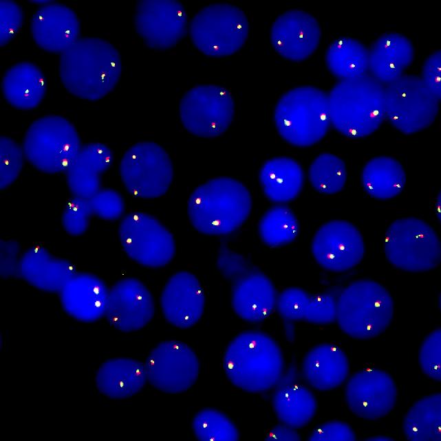 Aperio FL Systems - Brightfield, Fluorescent & FISH Scanning