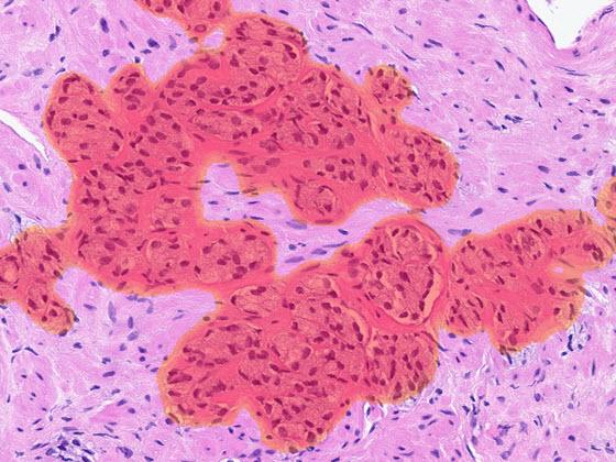 Prostate AI for H&E-Stained Prostate Sample Analysis
