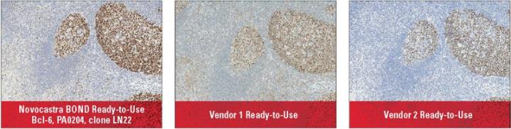 BOND-MAX | Automated Immunohistochemistry (IHC) Stainer