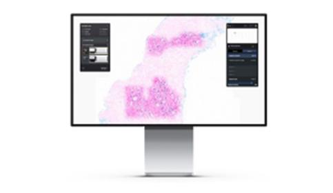 Aperio Digital Pathology Management Software| Leica Biosystems