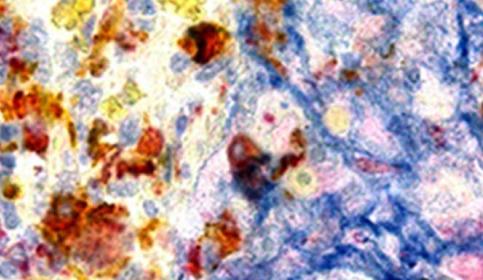 Advanced Staining Image Gallery | Leica Biosystems