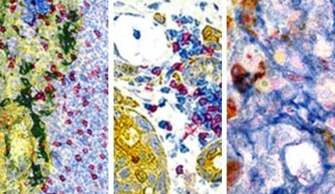 Cell IDx - Advanced Multiplex Biomarker Profiling | Leica Biosystems